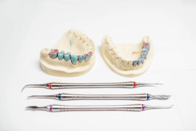 Quais são as indicações para inlay dental?