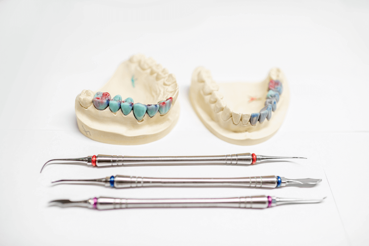 Quais são as indicações para inlay dental?